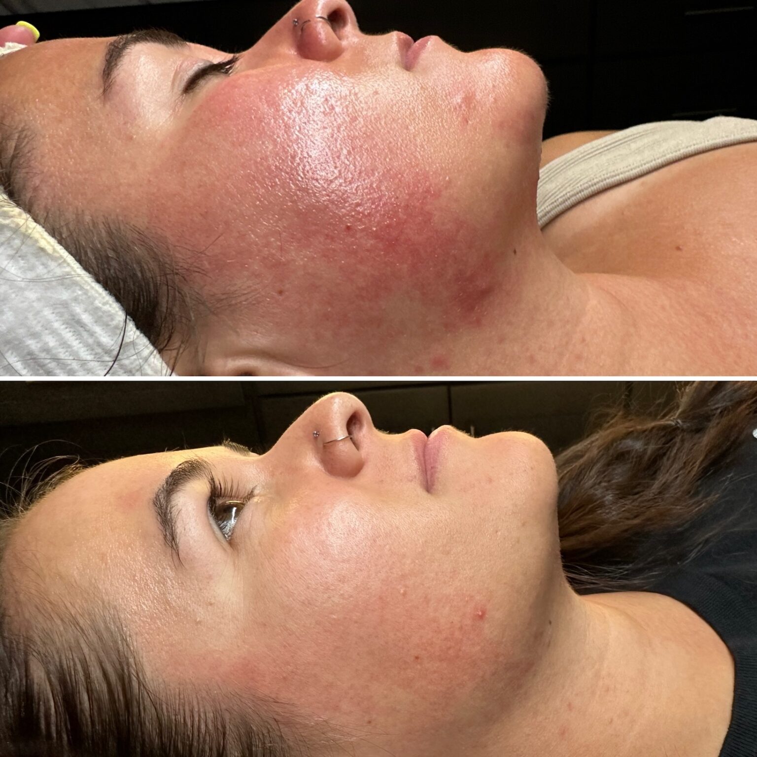 Face Reality 2 | Purity Skin Studio