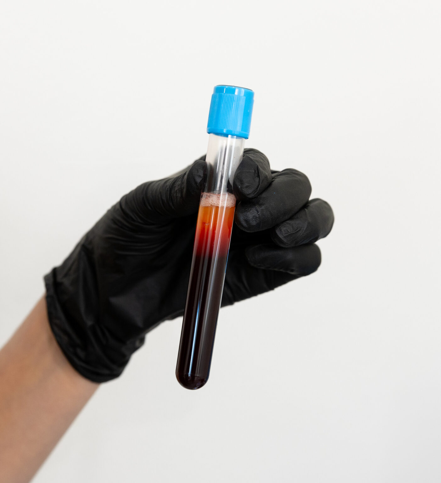 Med Spa in Highlands Ranch | Purity Skin Studio