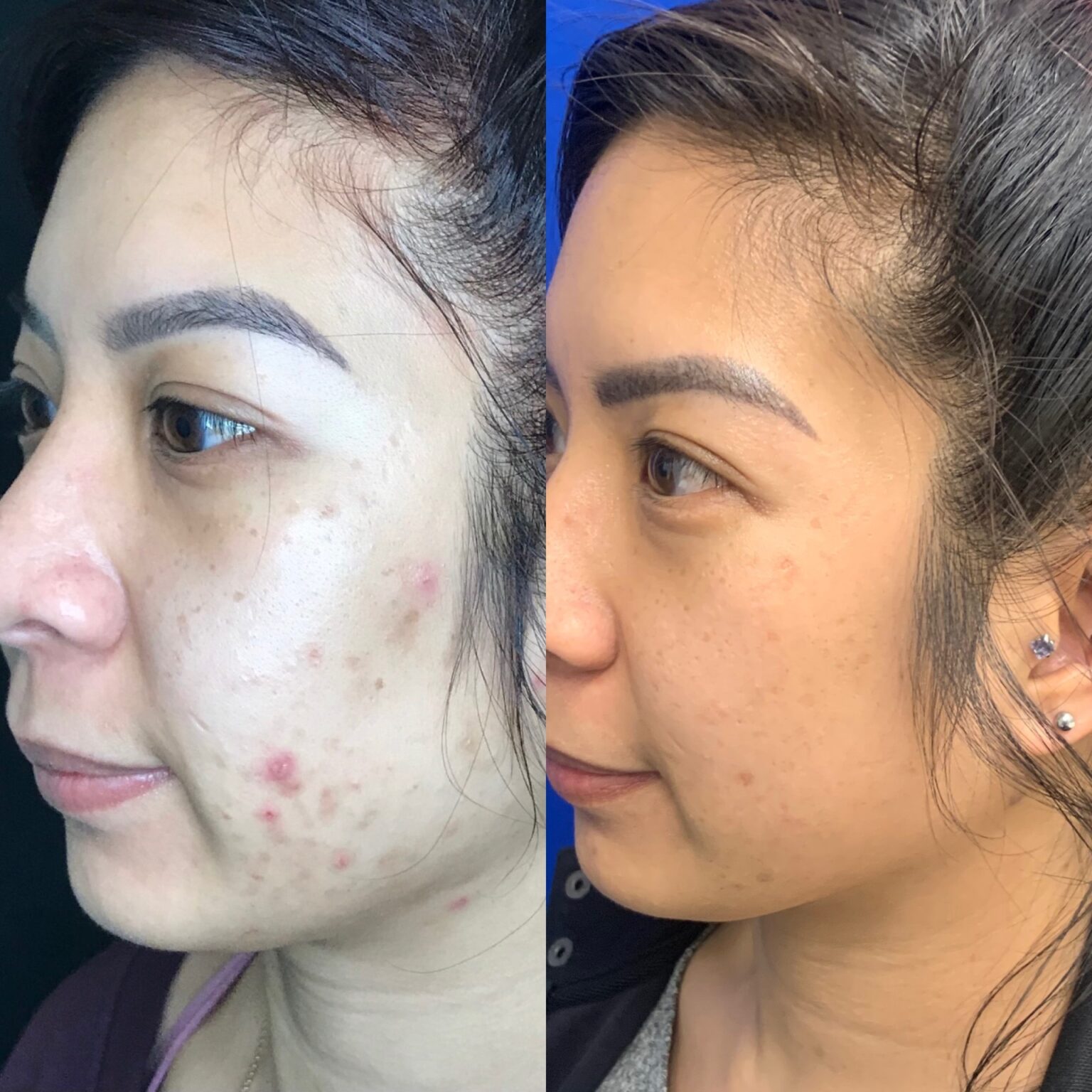 Face Reality 8 | Purity Skin Studio